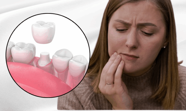 The Gap Between Your Dental Crown And Gums: How To Fix It?