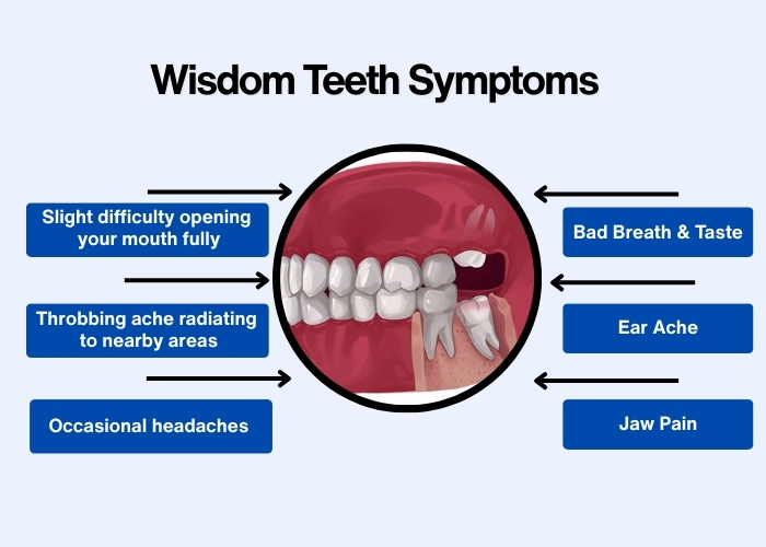 How Long Does It Take for a Wisdom Tooth to Emerge?